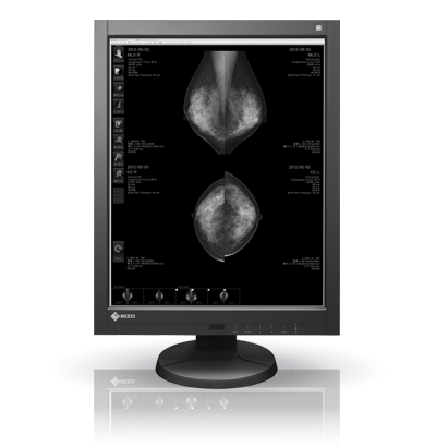 RadiForce Medical Monitors & Medical Imaging Solutions
